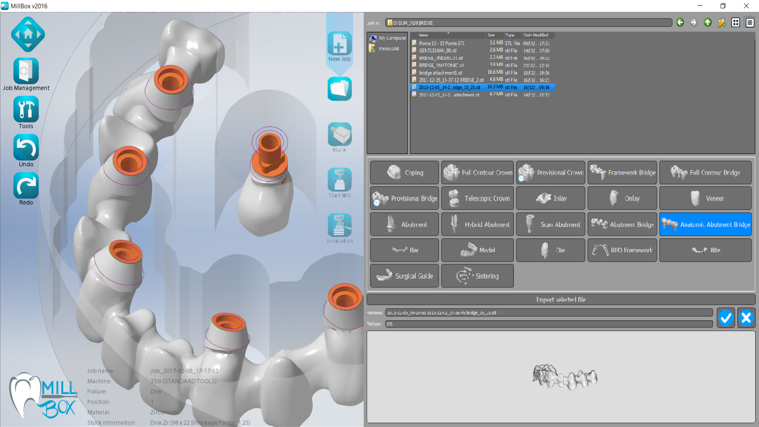 What is MillBox? - aboutsoft.org