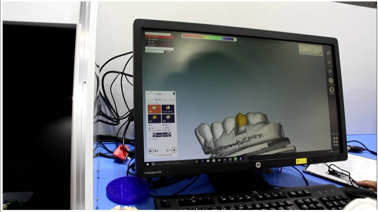 CAD/CAM in Dentistry - aboutsoft.org