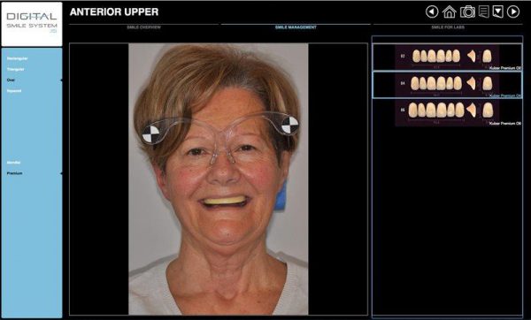 Digital Smile System - aboutsoft.org