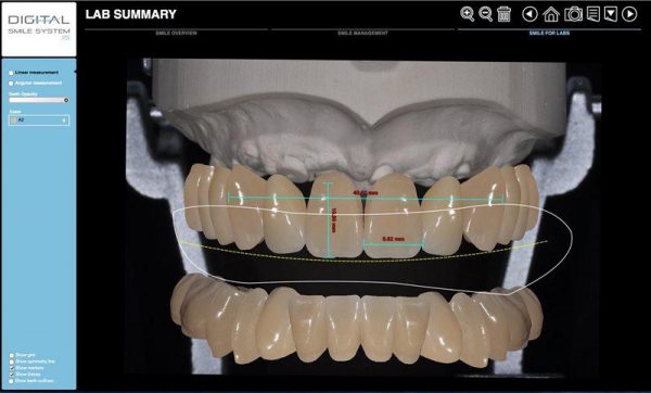Digital Smile System - aboutsoft.org