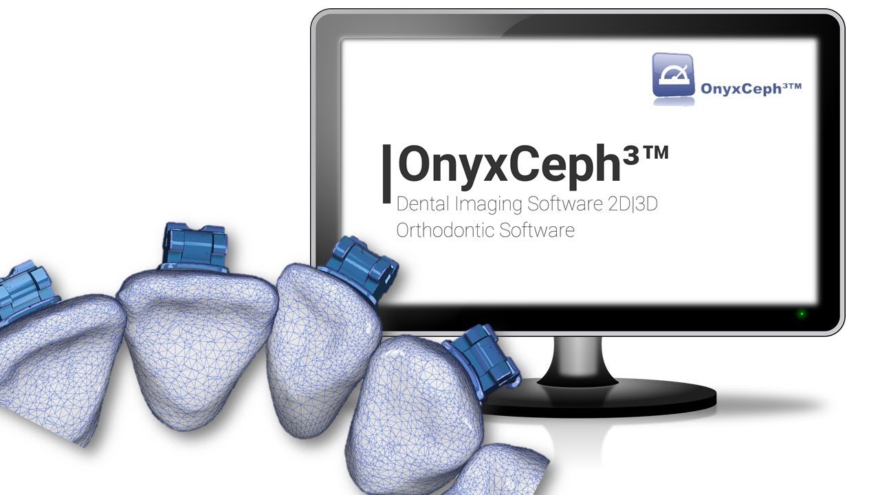 about OnyxCeph - aboutsoft.org