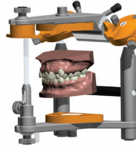 about 3Shape Ortho System crack and license - aboutsoft.org