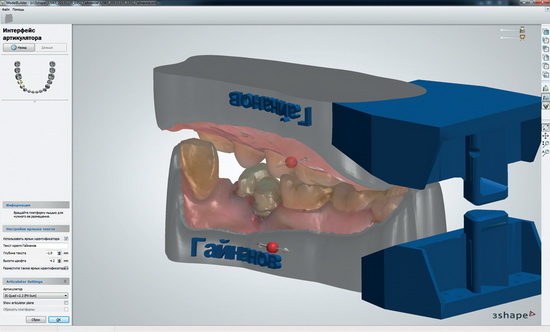 Model Builder crack from 3Shape – a simple way from a digital ...